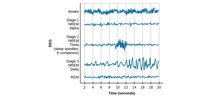 Sleep and EEG – Introduction to Neuroscience